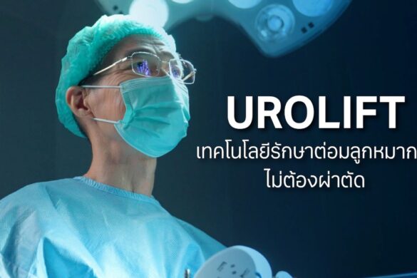 UROLIFT Archives - Brand Buffet