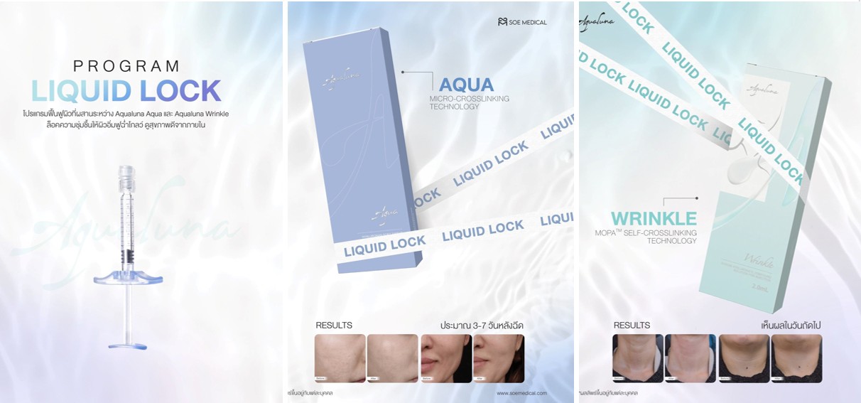 SOE Medical เปิดตัว “Aqualuna Liquid Lock” ครั้งแรกในไทย นวัตกรรมเจลงาน ...